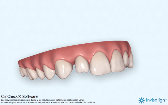 Medidas ideales de los dientes • Alba & Hernanz